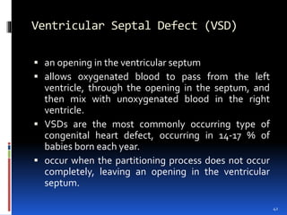 CONGENITAL HEART DISEASES | PPTX