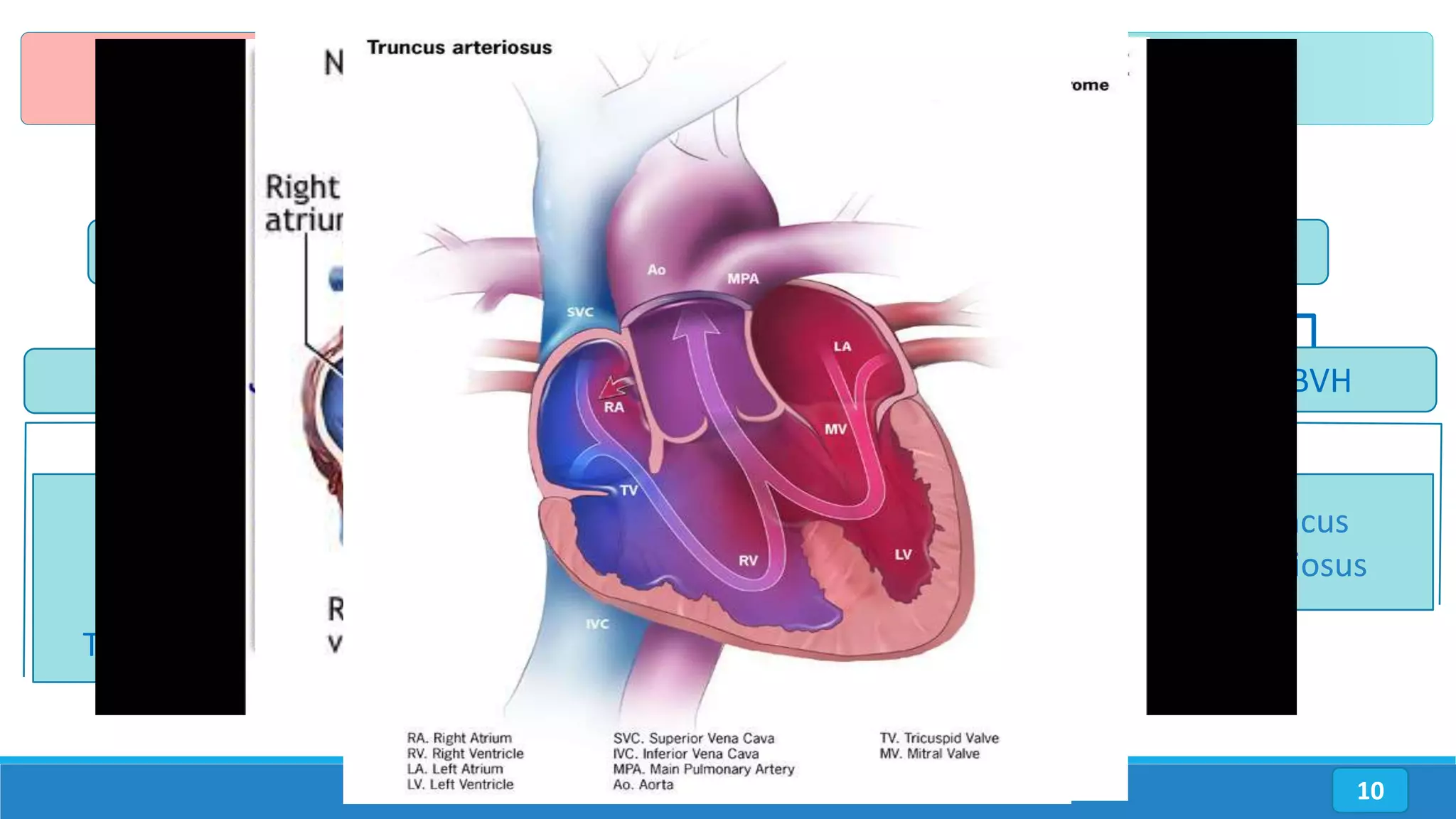 Congenital structural heart defects. | PPT