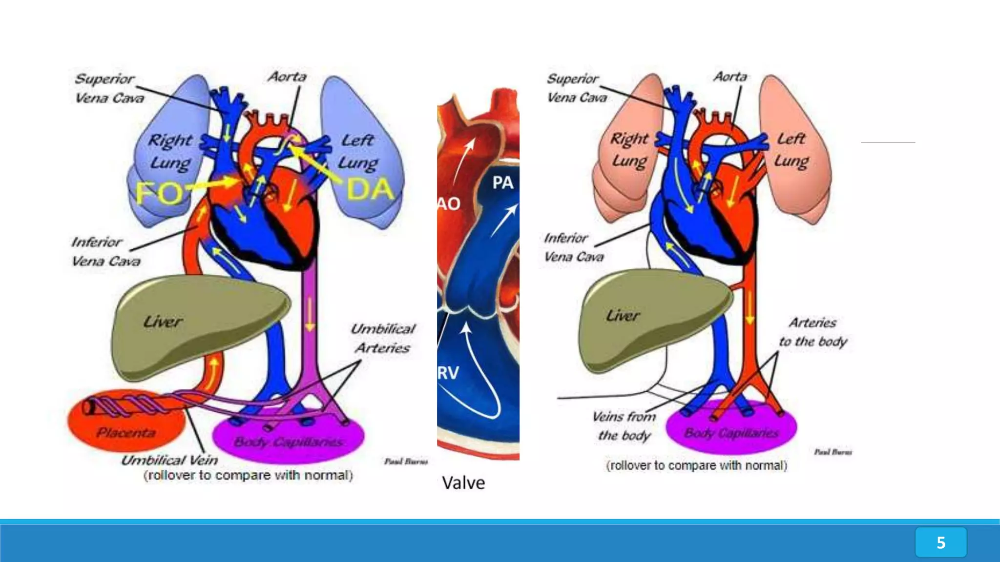 Congenital structural heart defects. | PPT