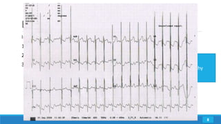Congenital structural heart defects. | PPT