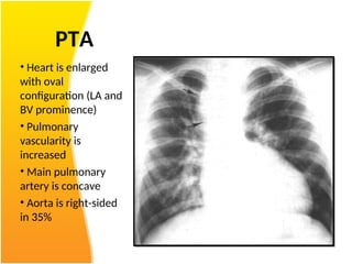 Congenital Heart Diseases Review for Medical Students | PPT