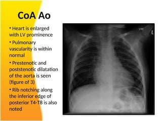 Congenital Heart Diseases Review for Medical Students | PPT