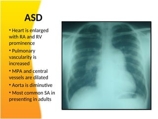Congenital Heart Diseases Review for Medical Students | PPT