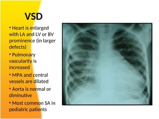 Congenital Heart Diseases Review for Medical Students | PPT