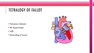 CHD - RL Shunts.pptx
