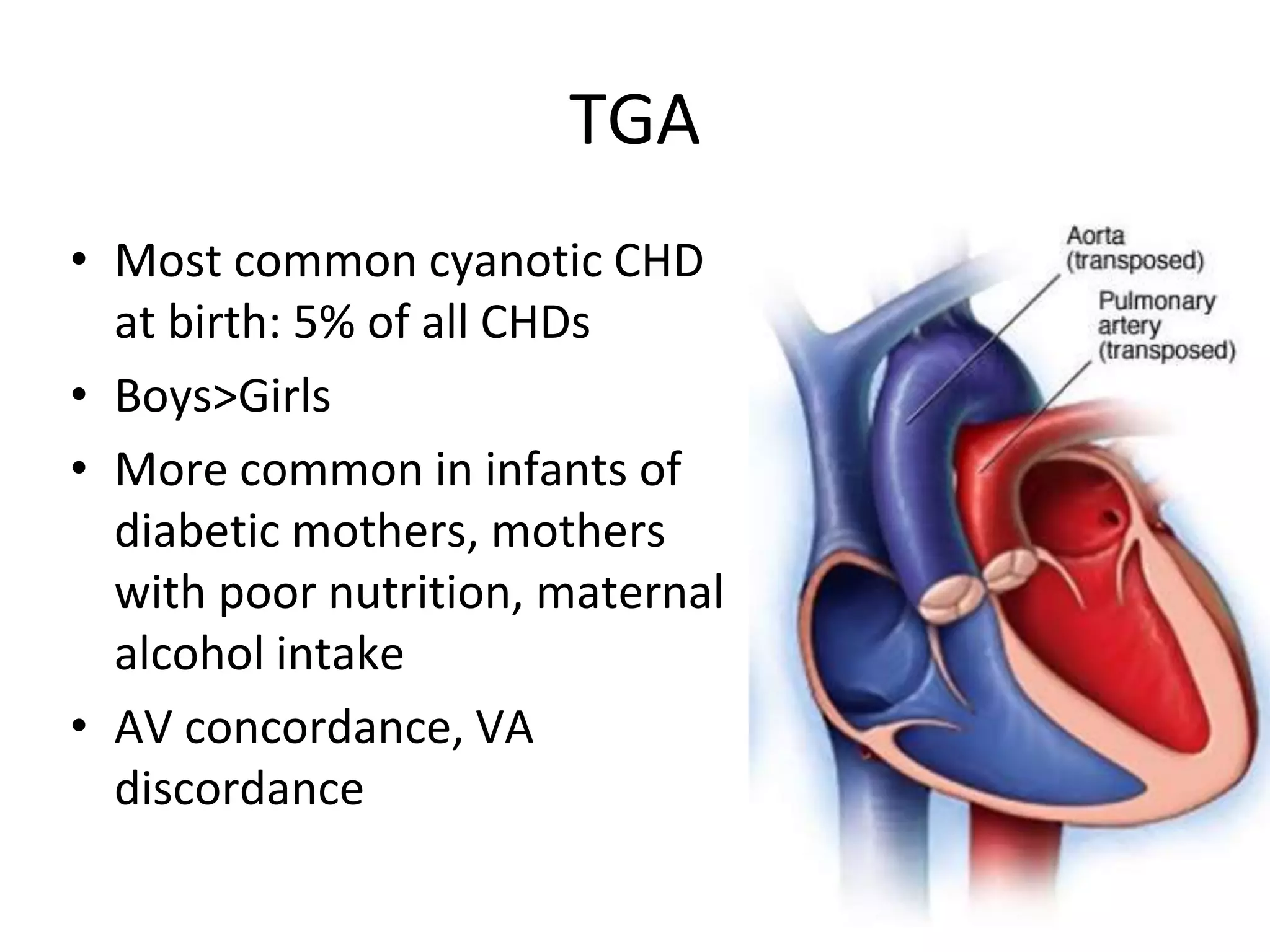 CONGENITAL HEART DISEASES: A SIMPLIFIED APPROACH | PPTX