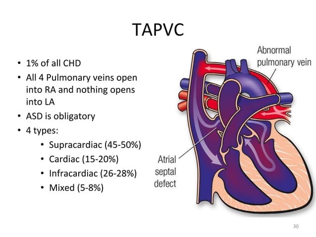 CONGENITAL HEART DISEASES: A SIMPLIFIED APPROACH | PPT