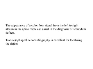 Echocardiography of CHD in Adults | PPTX