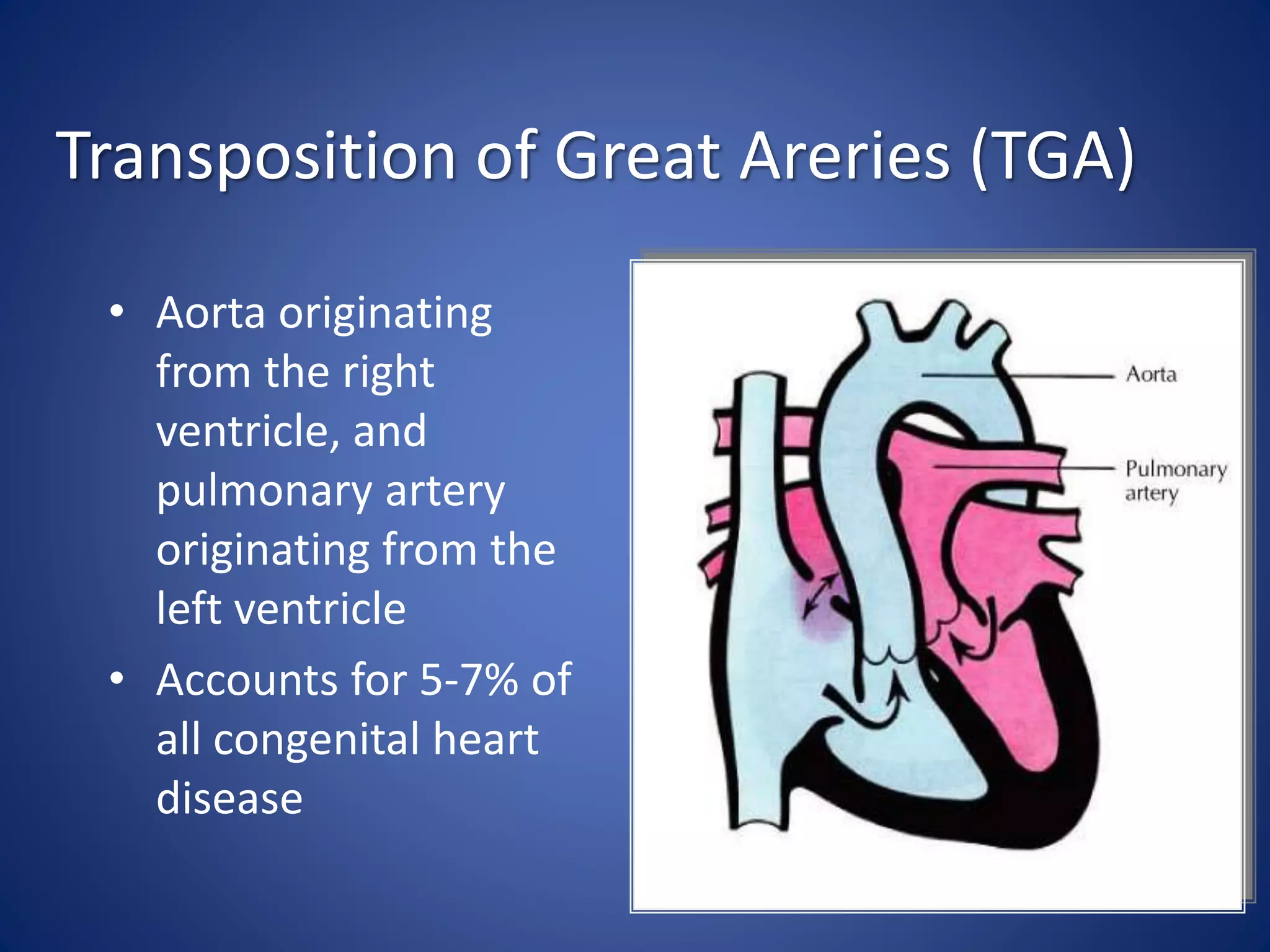 Congenital Heart Disease | PPTX