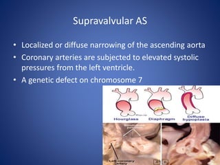 Congenital Heart Disease | PPTX