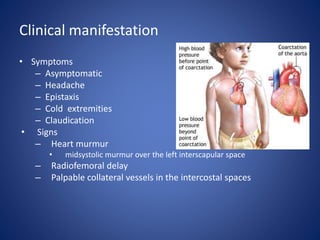 Congenital Heart Disease | PPTX