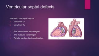 Antenatal Diagnosis of Fetal Heart Disease | PPTX