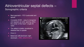 Antenatal Diagnosis of Fetal Heart Disease | PPTX