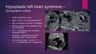 Antenatal Diagnosis of Fetal Heart Disease | PPTX
