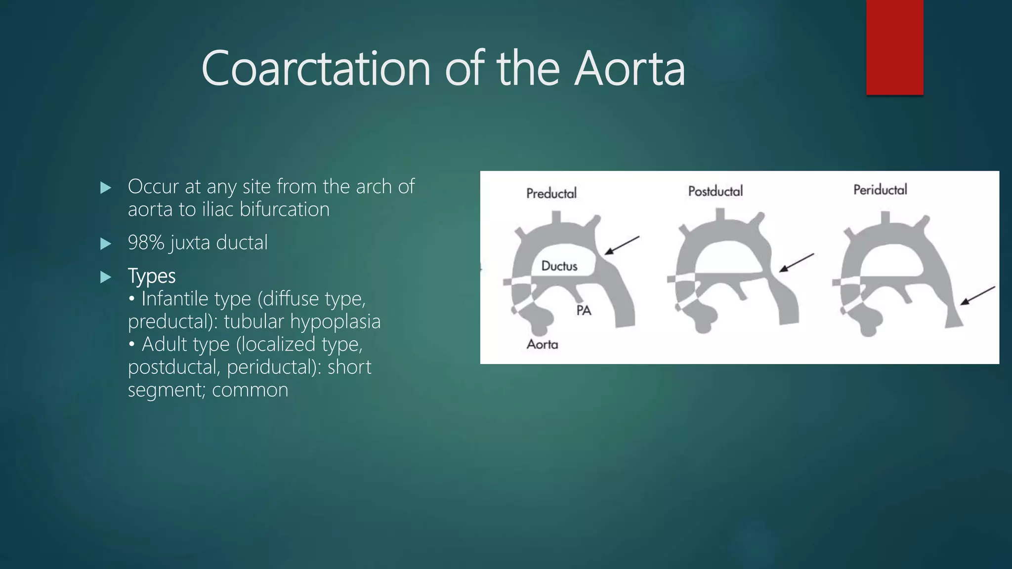 Radiographic Presentation of Congenital Heart Disease | PPTX