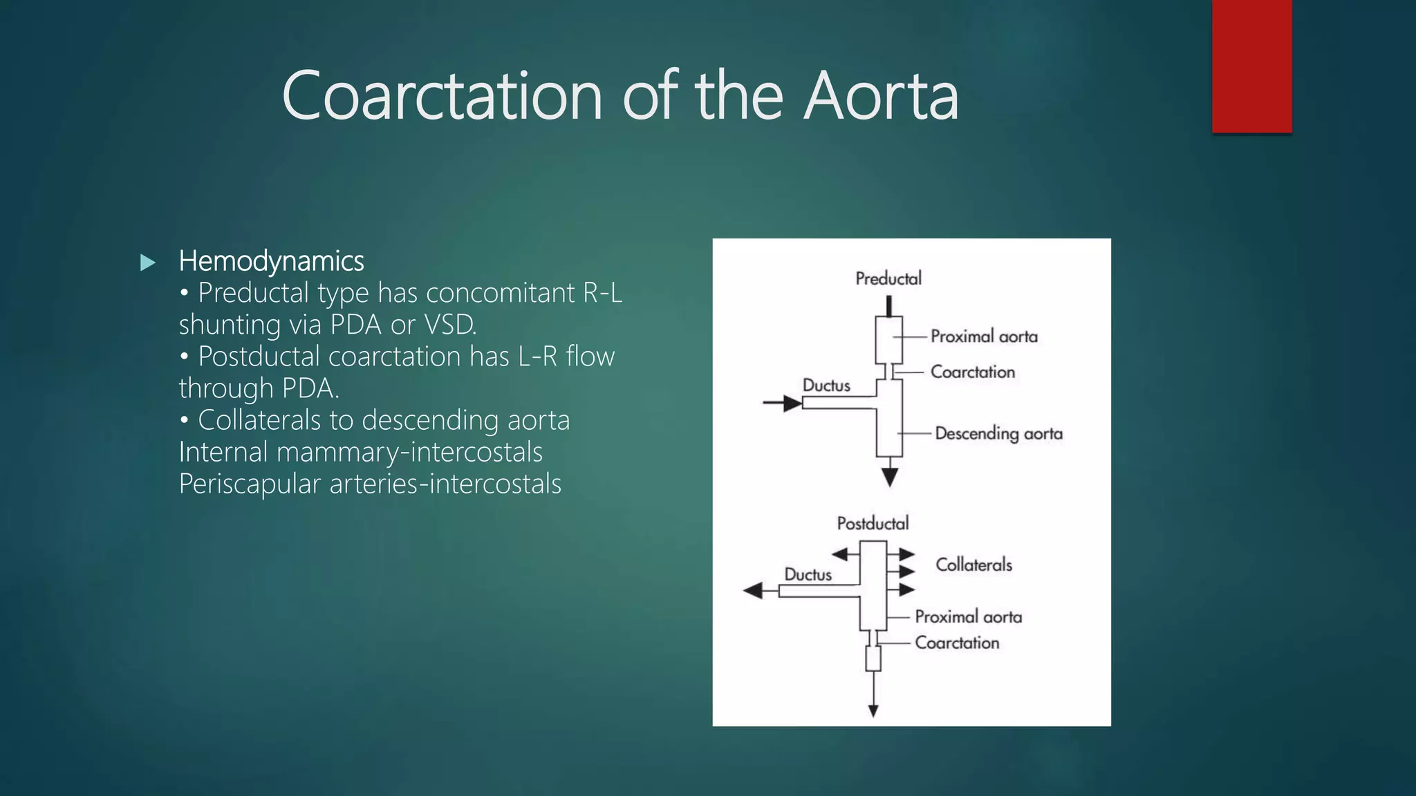 Radiographic Presentation of Congenital Heart Disease | PPTX