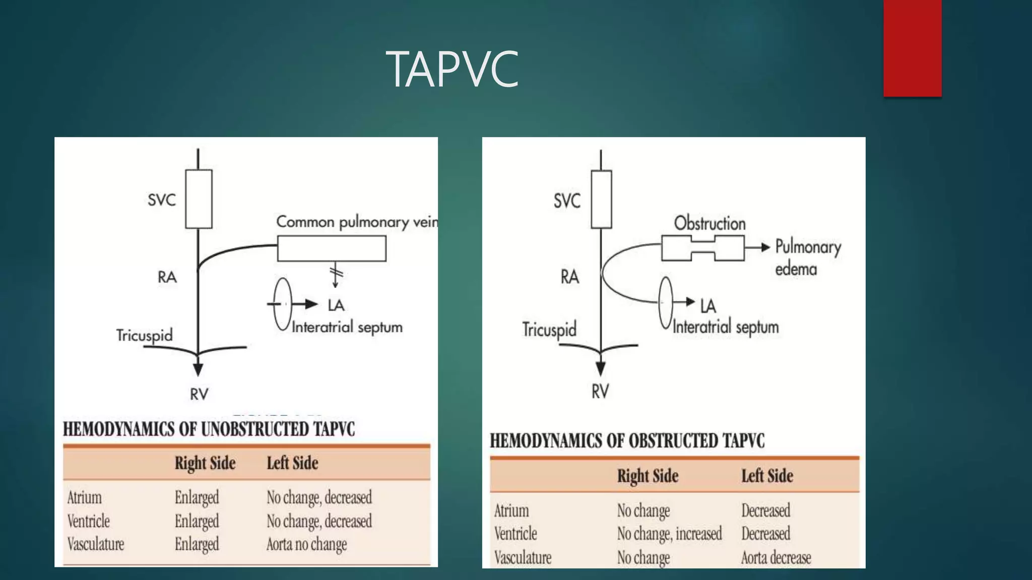 Radiographic Presentation of Congenital Heart Disease | PPTX