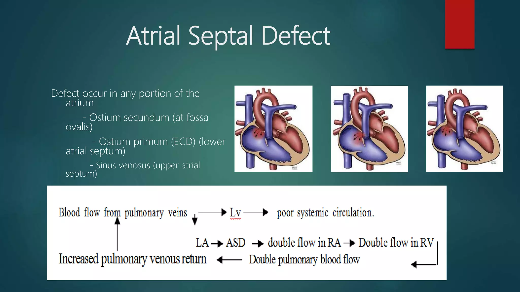 Radiographic Presentation of Congenital Heart Disease | PPTX