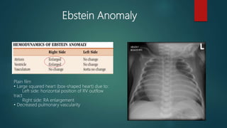 Radiographic Presentation of Congenital Heart Disease | PPTX