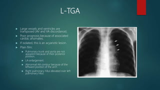 Radiographic Presentation of Congenital Heart Disease | PPTX