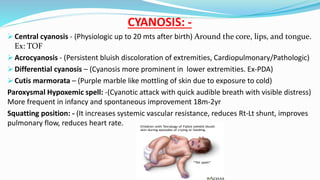 Congenital Heart Disease & Surgical Management | PPTX