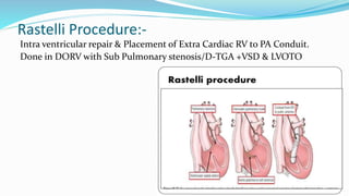 Congenital Heart Disease & Surgical Management | PPT