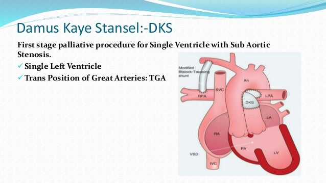 Congenital Heart Disease & Surgical Management