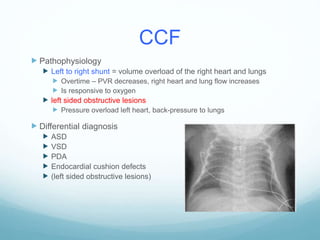 Paediatric Congenital Heart Defects Case Presentation | PPTX