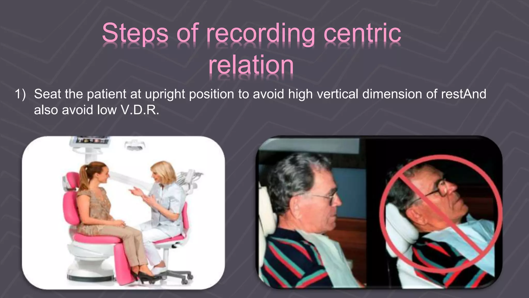 Check bite technique | PDF