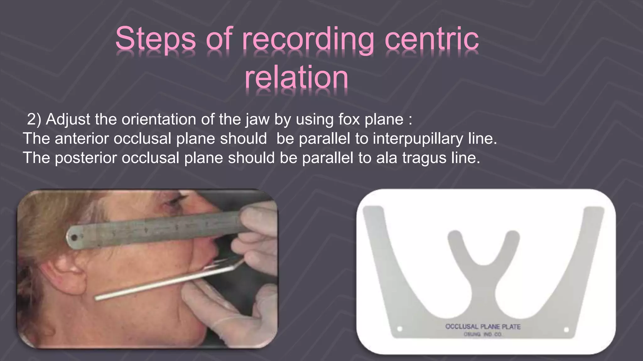 Check bite technique | PDF