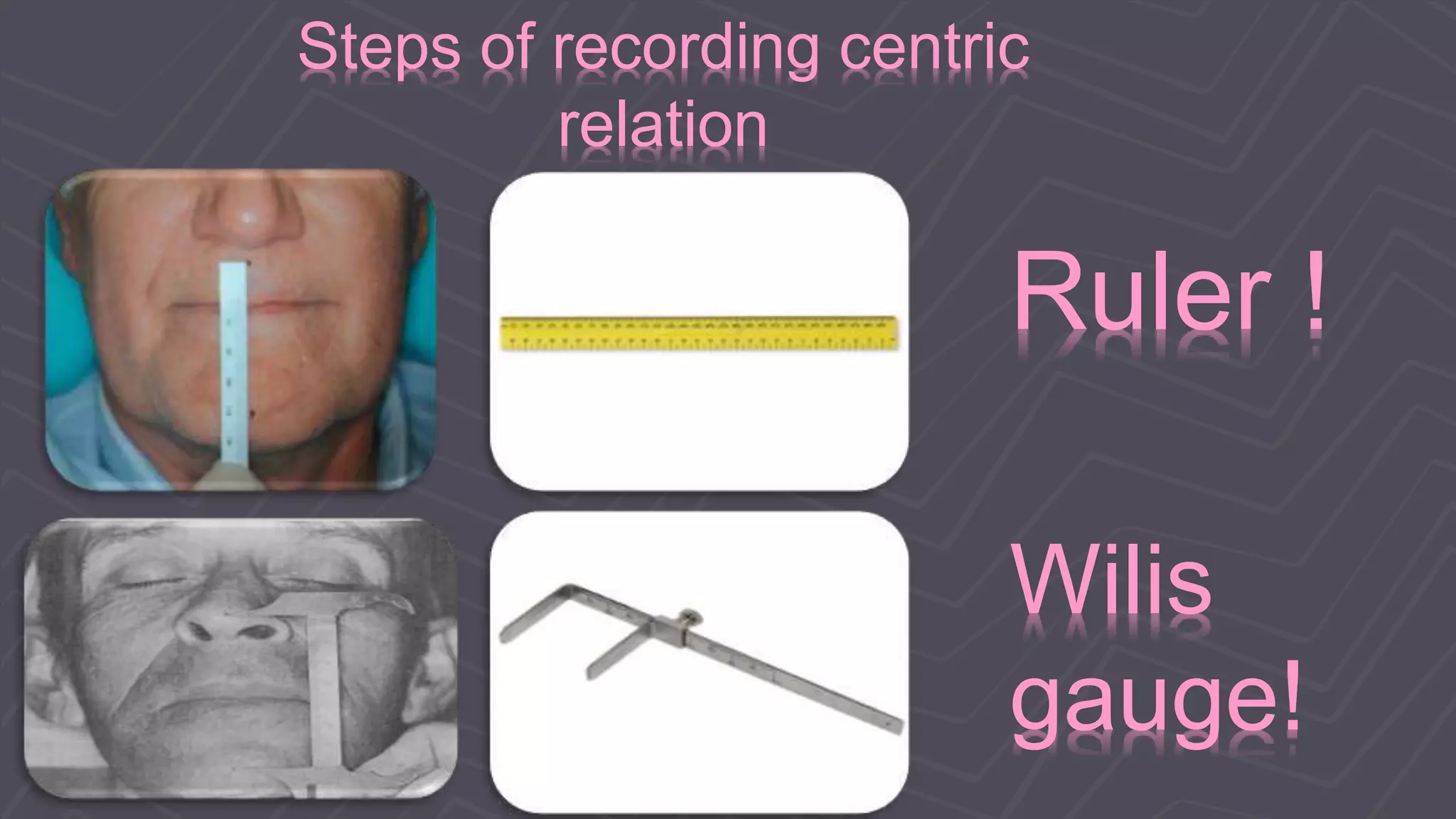 Check bite technique | PDF