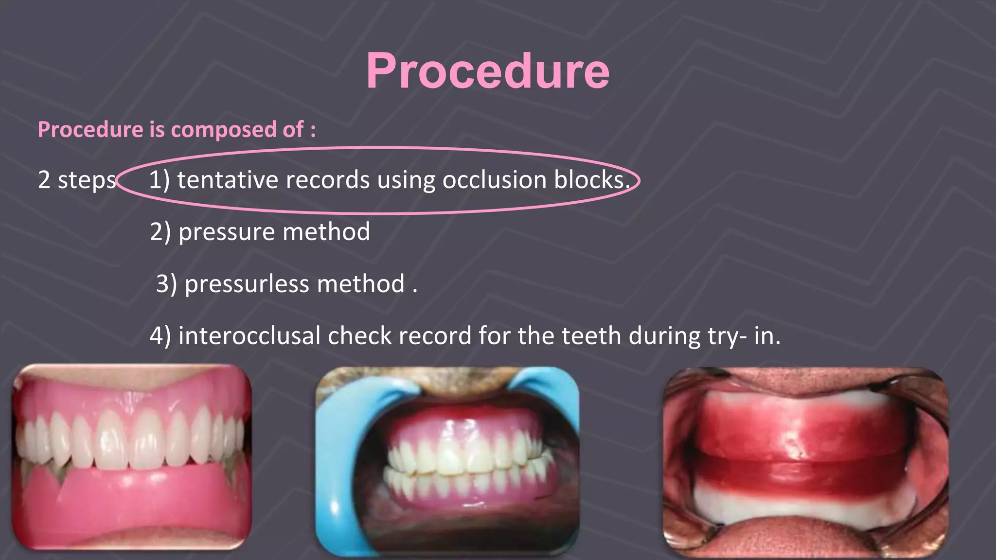 Check bite technique | PDF