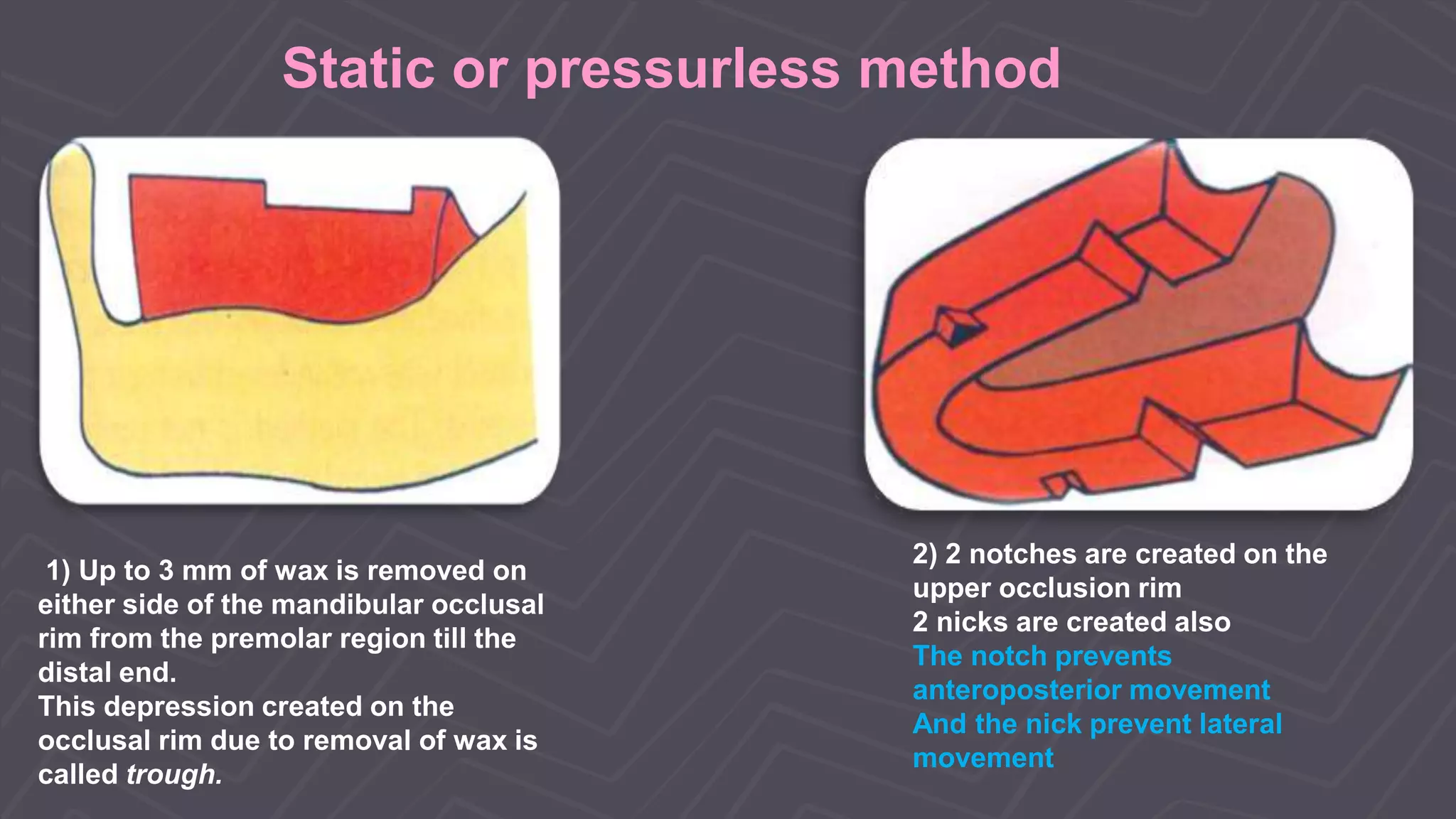 Check bite technique | PDF