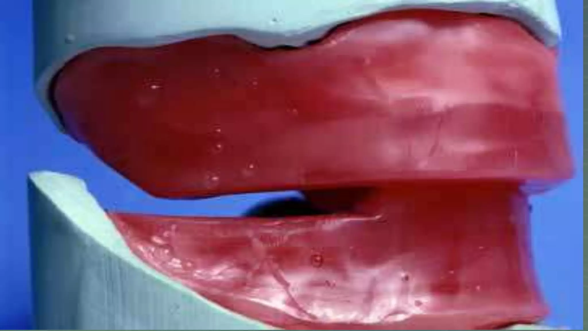 Check bite technique | PDF