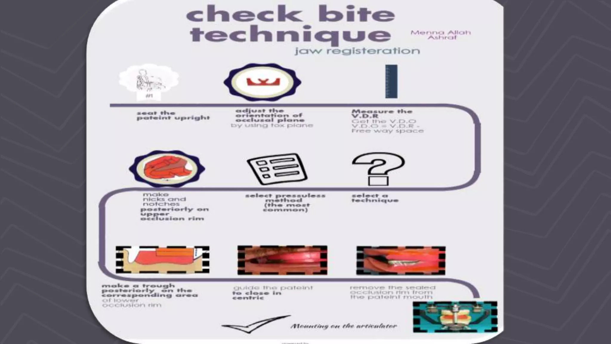 Check bite technique | PDF