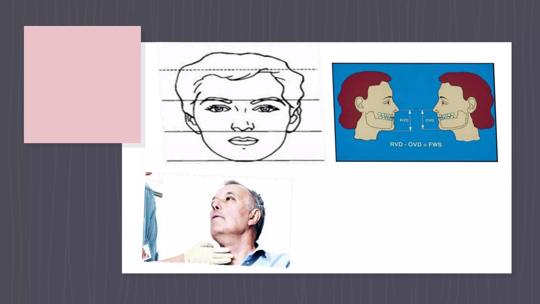 Check bite technique | PDF