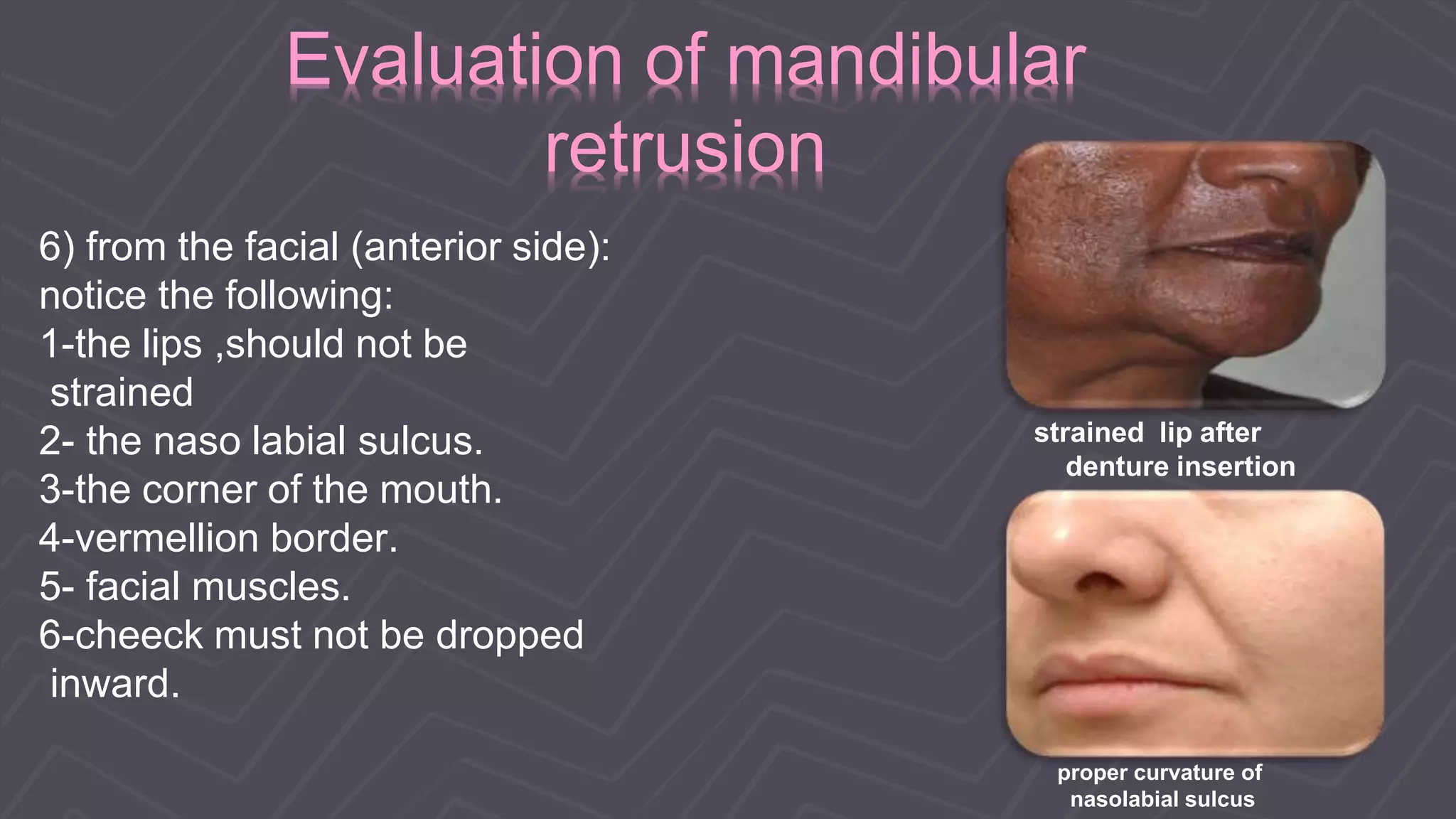 Check bite technique | PDF