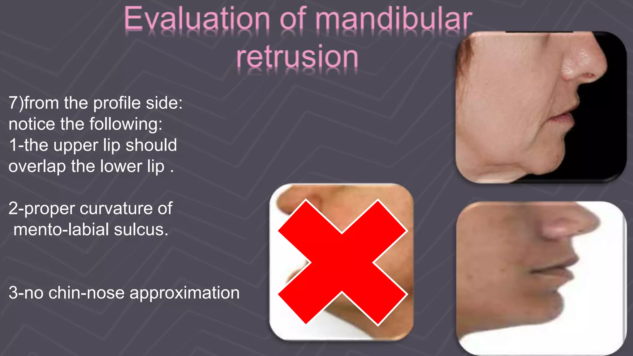 Check bite technique | PDF