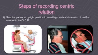 Check bite technique | PDF