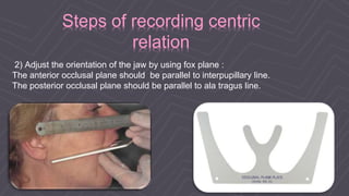 Check bite technique | PDF