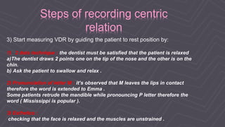 Check bite technique | PDF