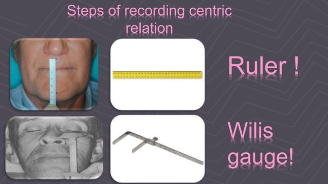 Check bite technique | PDF