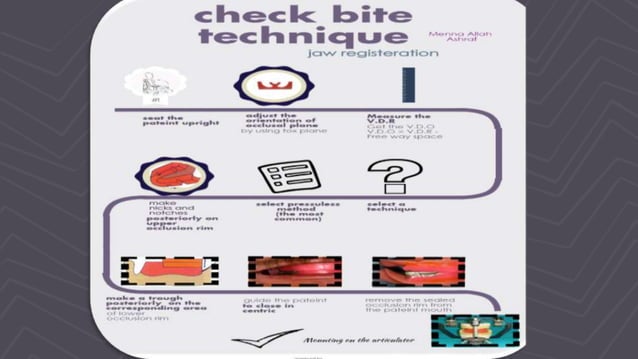 Check bite technique | PDF