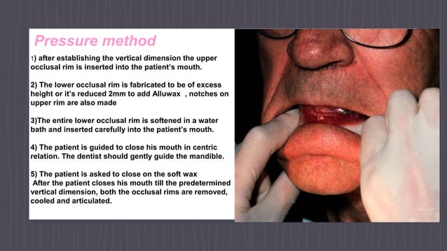 Check bite technique | PDF