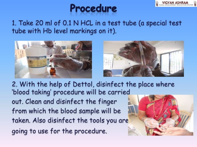 Checking of haemoglobin level | PPTX