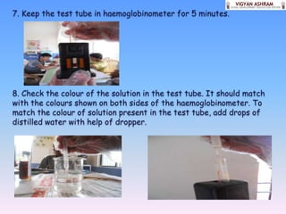 Checking of haemoglobin level | PPTX