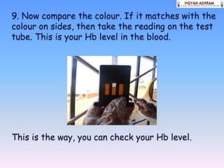 Checking of haemoglobin level | PPTX