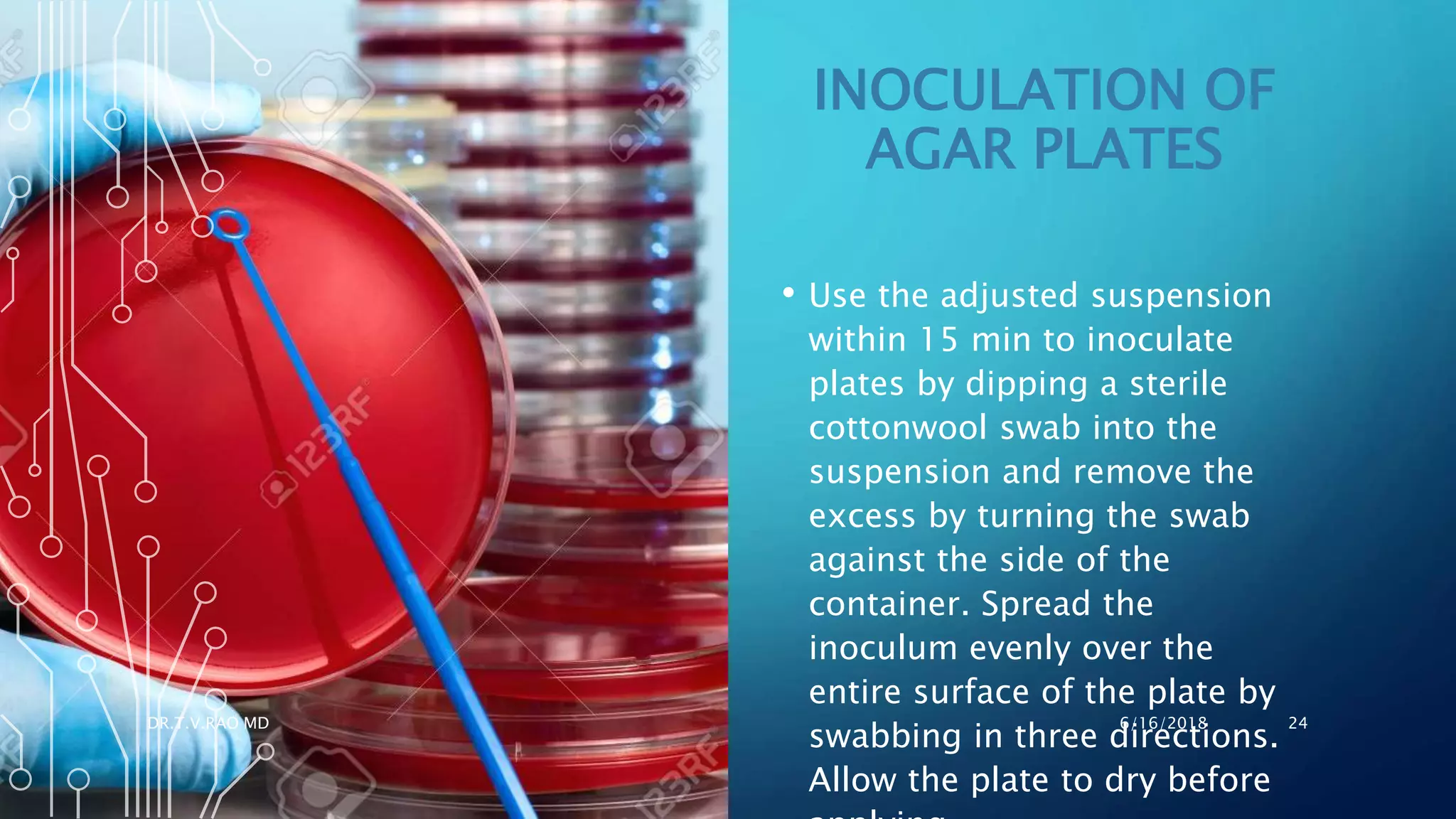 Basics for culturing and antimicrobial sensitivity testing in ...
