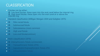 examination of the fistula | PPT