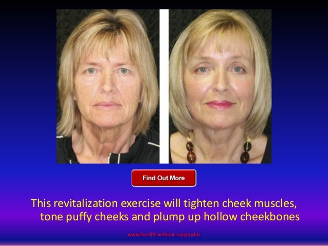 Cheek Plumping Exercises: Build Sunken Cheeks And Tighten Flabby Chee…